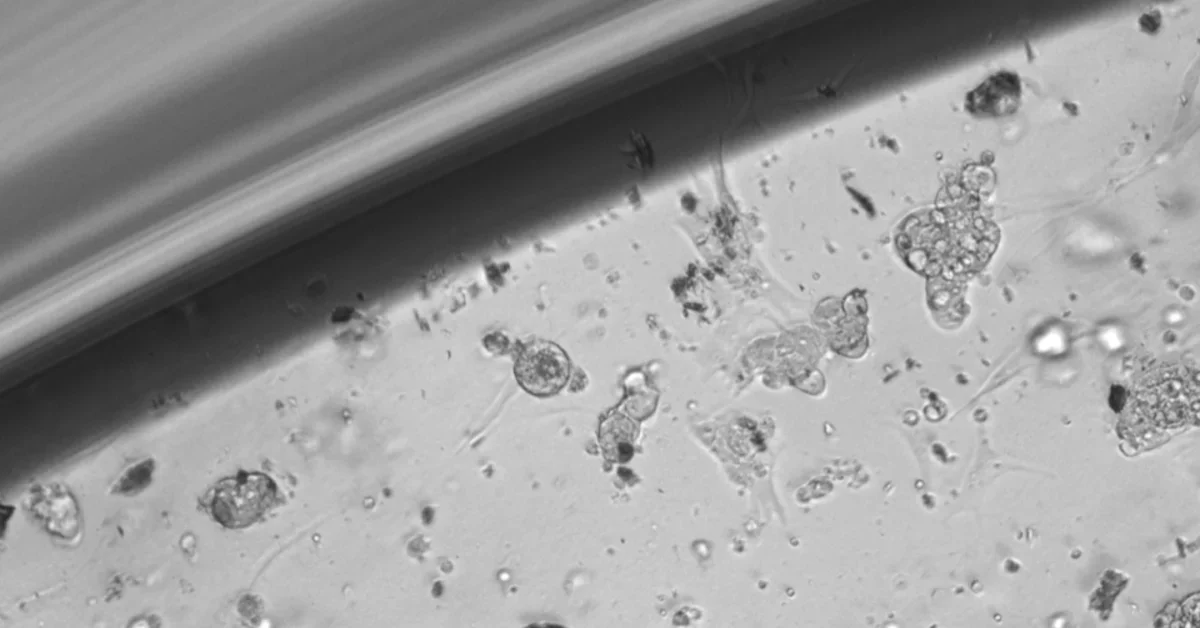 Researchers create personalized organoid models for rare spinal cancer ...